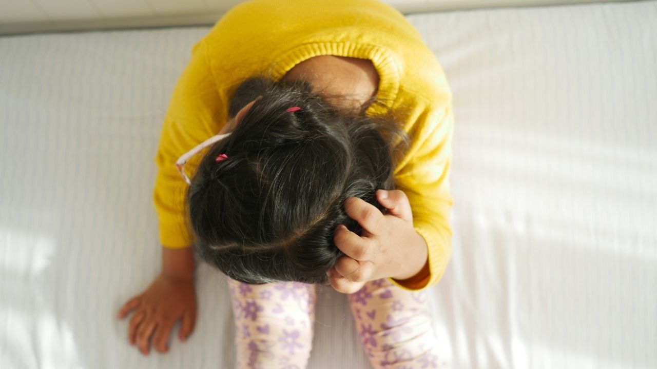Dandruff Pictures In Children Seborrheic Dermatitis Walk In